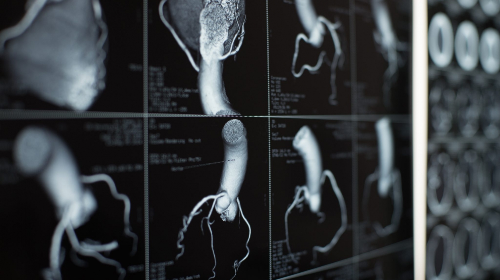 Section Spotlight – Cardiovascular and Thoracic Imaging - Diagnostic ...
